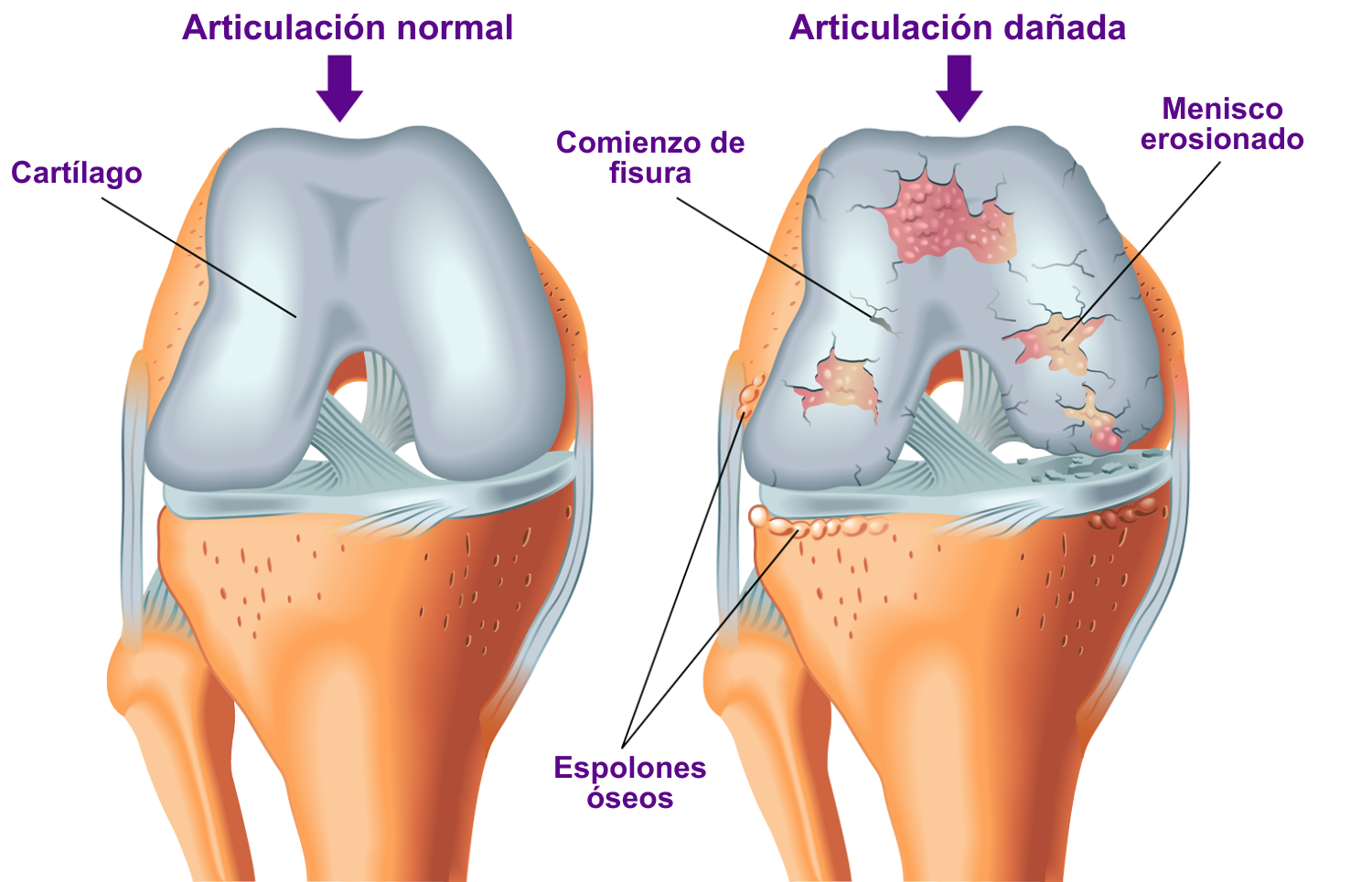 Fórmula Articulations MAX-8 - Cell'innov